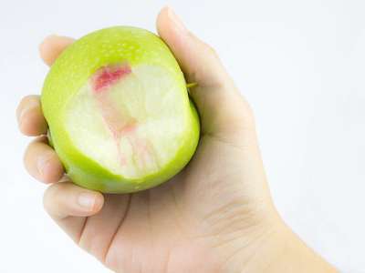 How To Protect Gums From Bleeding Naturally In Daily Life? | Dimed Laser