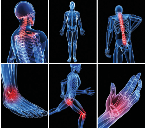 Laser Therapy Pain Relief Machine For Body Pain Management | Dimed Laser